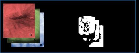 A Feature Extraction Module Architecture [6] Download Scientific Diagram