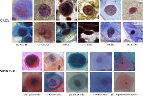 Figure 4 From Cvm Cervix A Hybrid Cervical Pap Smear Image Classification Framework Using Cnn