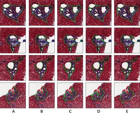 Qualitative Comparison Of Deep Learning Models For Normal Liver Portal Download Scientific