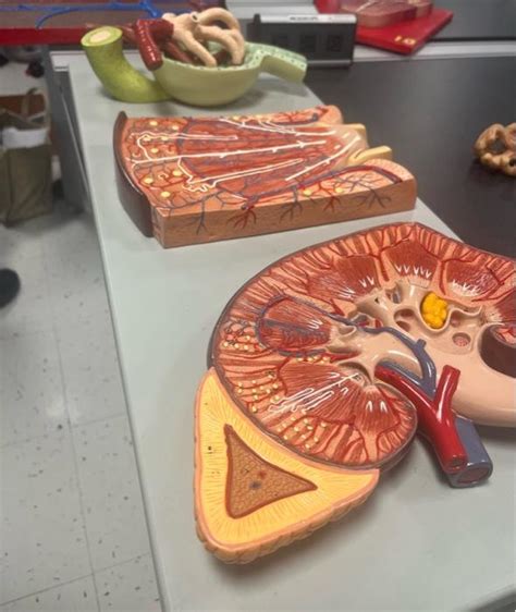 Solved Label I Just Need To Know What Is This Model And Chegg