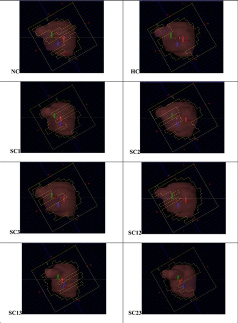 Example Machines Multileaf Collimator Mlc Beams‐eye‐view Aperture At Download Scientific