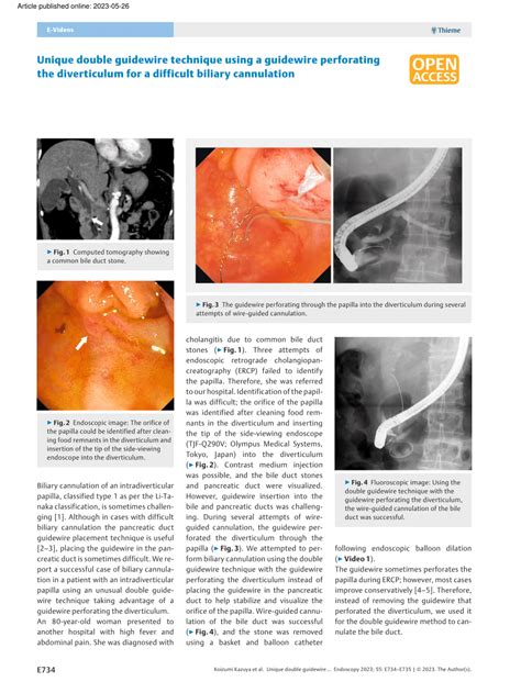 Pdf Unique Double Guidewire Technique Using A Guidewire Perforating