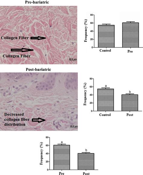 Histological Analysis And Quantitative Analysis Of Relative Frequency Download Scientific