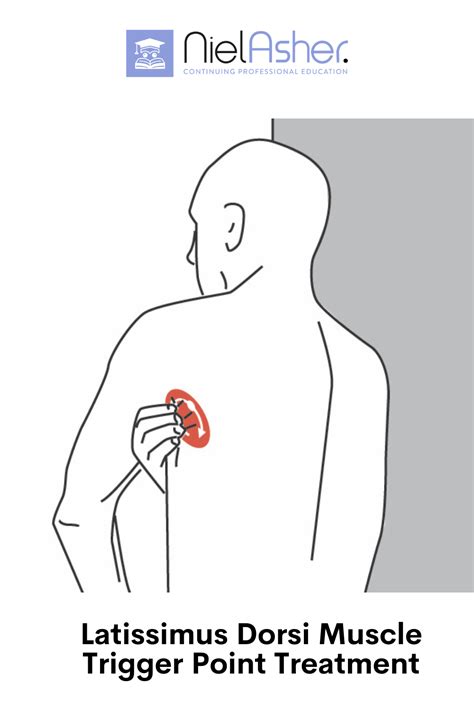 Trigger Point Therapy Treating Gluteus Medius And Minimus Artofit
