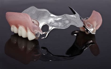 Acrylic Partial With Framework Dental Lab Dental Restoration Dental