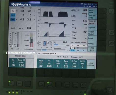 Flowmeter In Anaesthesia Machine At Robin Clark Blog