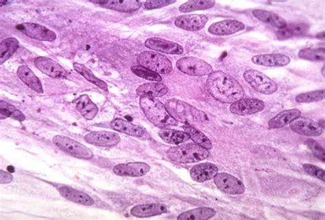 Papain Health Benefits Side Effects Uses Dose And Precautions
