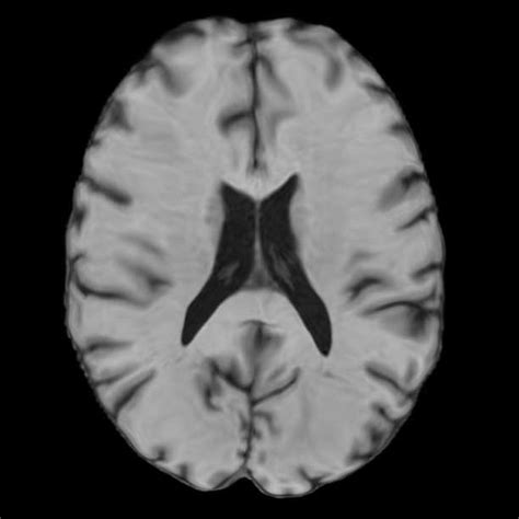 Comparison Of The Proposed Statistical Registration Against Ffd Download Scientific Diagram