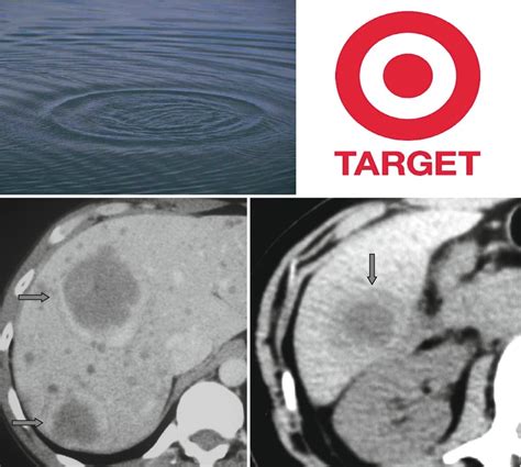 Target Sign