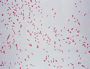 Pseudomonas Aeruginosa Under Microscope Gram Staining