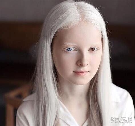 عکس سفید ترین آدم جهان عکس نودی