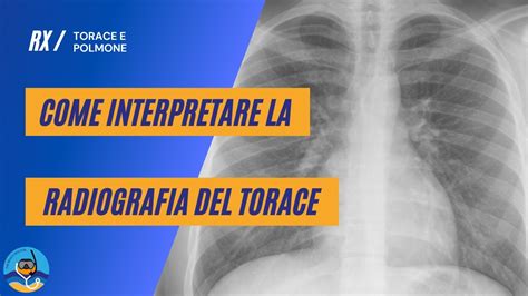 Come Interpretare La Radiografia Del Torace Youtube