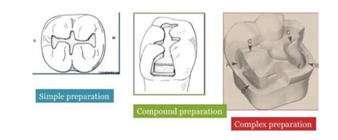 3 Classification Of Cavities Stages Of Cavity Preparation Flashcards