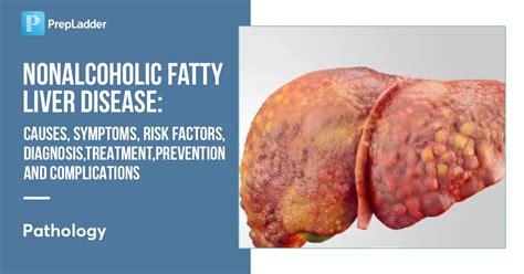 Nonalcoholic Fatty Liver Disease Nafld Fx Medicine