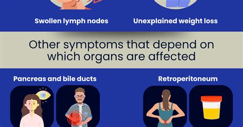 Igg4 Related Disease Symptoms Igg4 Rd News