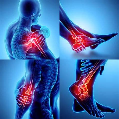 Symptoms Of Arthritis How To Cure And Get Treatment Of Arthritis