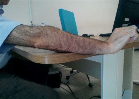 Eccentric Contraction Exercise Download Scientific Diagram