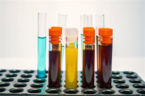 다채로운 실험실 테스트 튜브 생화학 혈액 검사 소변 검사 테스트 튜브 의료 분석 연구 개념 다 산 연구 0명에 대한 스톡 사진 및 기타 이미지 Istock