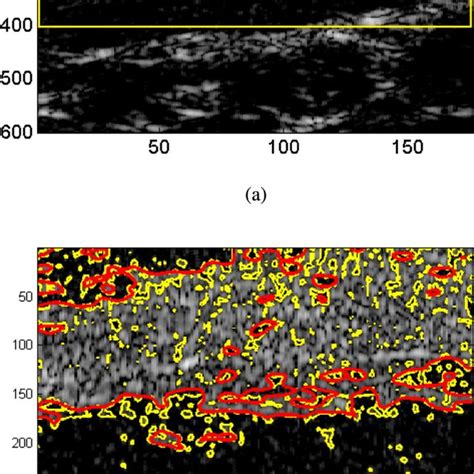 Comparison Of Our Method Red With Eulers Method Yellow On A Download Scientific Diagram