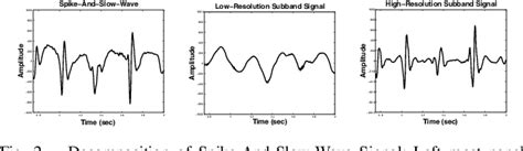 Figure 2 From Patient Specific Seizure Onset Detection Semantic Scholar