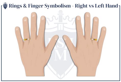 Wedding Ring Finger Swelling