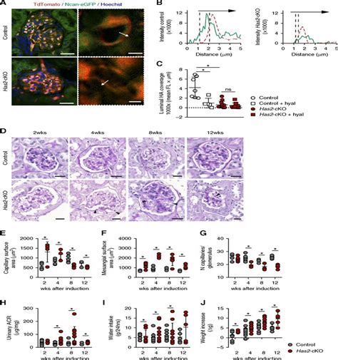 Glomerular Function And Structural Integrity Depend On Hyalu