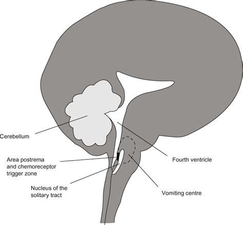 Prevention And Treatment Of Postoperative Nausea And Vomiting