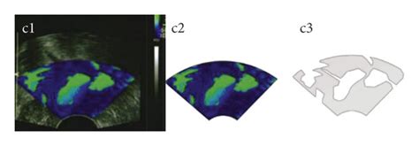 Diagram Of Ultrasonic Elastic Imaging Analysis Under The Deep Learning