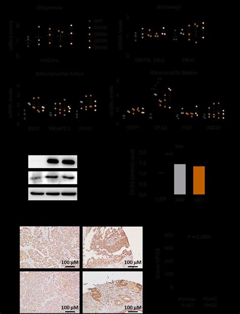 Oncogenic K Ras Activation Induces Opa3 Expression In Hpne Cells