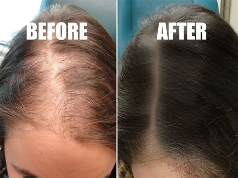 Hair Care Tips कंगवा फिरवताच खूप केस हातात येतात दाट लांबसडक