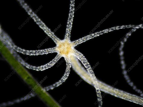 Freshwater Polyp Light Micrograph Stock Image C055 9422 Science Photo Library