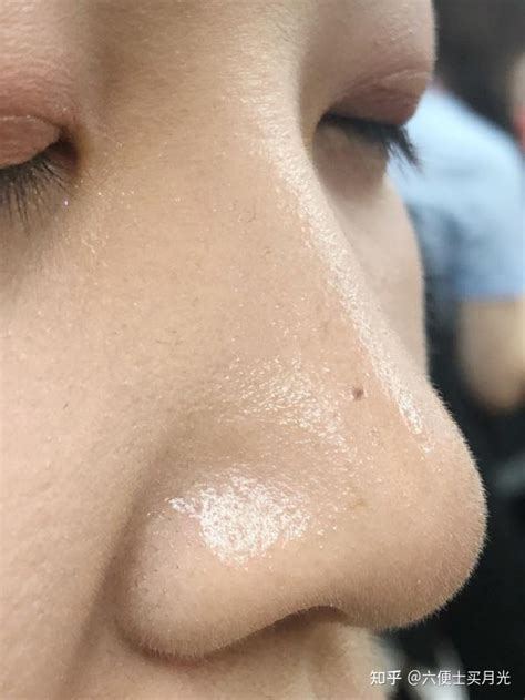 有什么吹爆的去黑头的办法？ 知乎