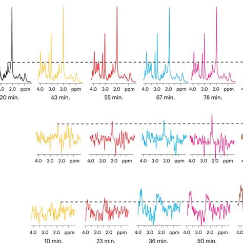 Quantification Of Sv Mr Spectra Obtained In The Posterior Cingulum With