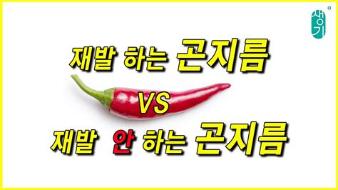 곤지름 성기 사마귀가 재발 하는 사람과 하지 않는 사람의 차이 여기에 해답이 있습니다 Youtube