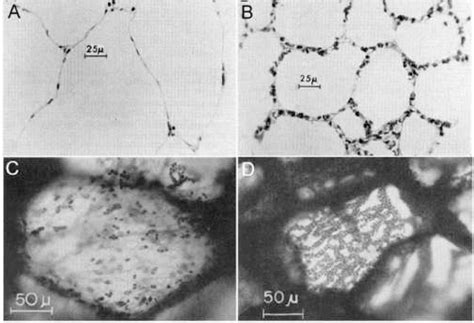 Figure 1 From Minimal Distensibility Of Pulmonary Capillaries In Avian