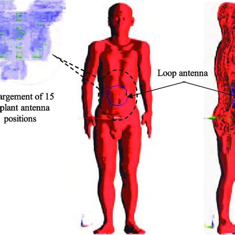 Fdtd Simulation Model Of An Anatomical Human Body With Implant And Download Scientific Diagram