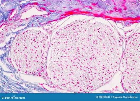 Characteristics Tissue Of Olfactory Epithelium Human Under The