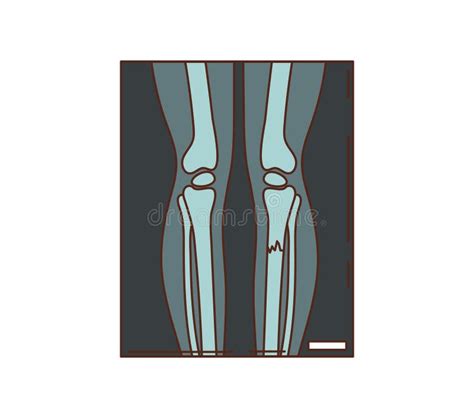 Xray Cartoon Stock Illustrations 4428 Xray Cartoon Stock Illustrations Vectors And Clipart