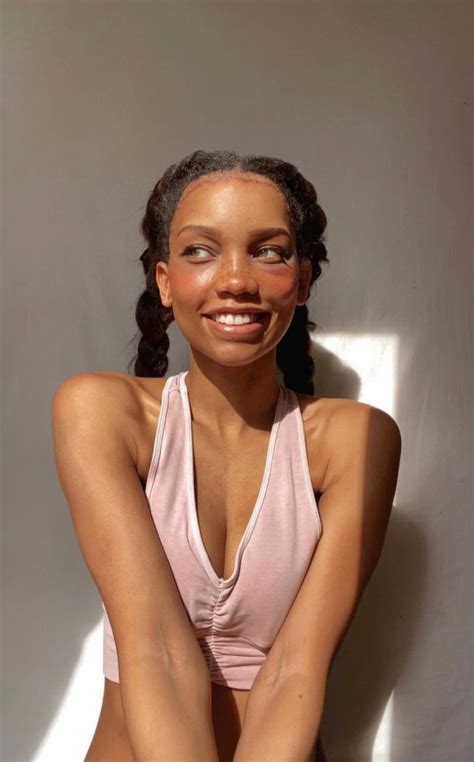 Model Pays To Reduce The Size Of Her Forehead By Cm