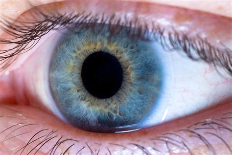 Can I Wear Normal Contact Lenses With Astigmatism For Eyes Blog
