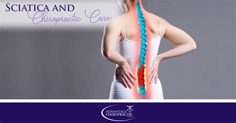 Sciatica And Chiropractic Care