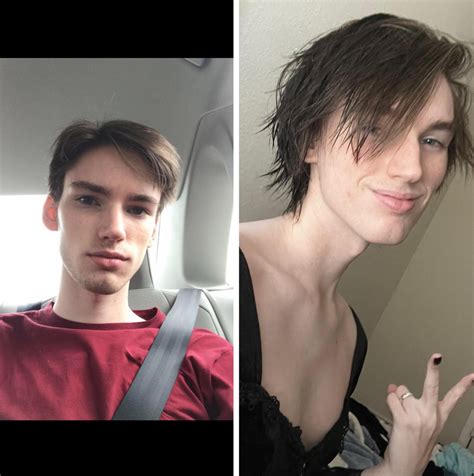 2yrs To 1yr Hrt And Laser Rtranstimelines