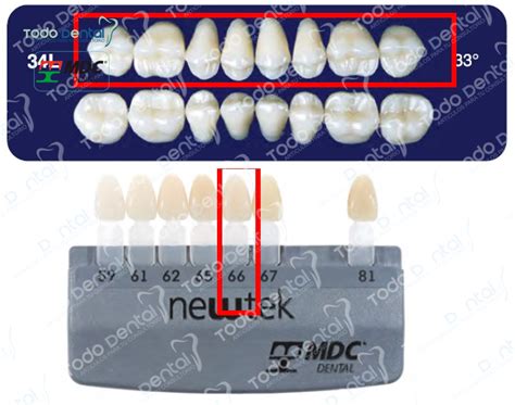 Diente New Tek Posterior Superior