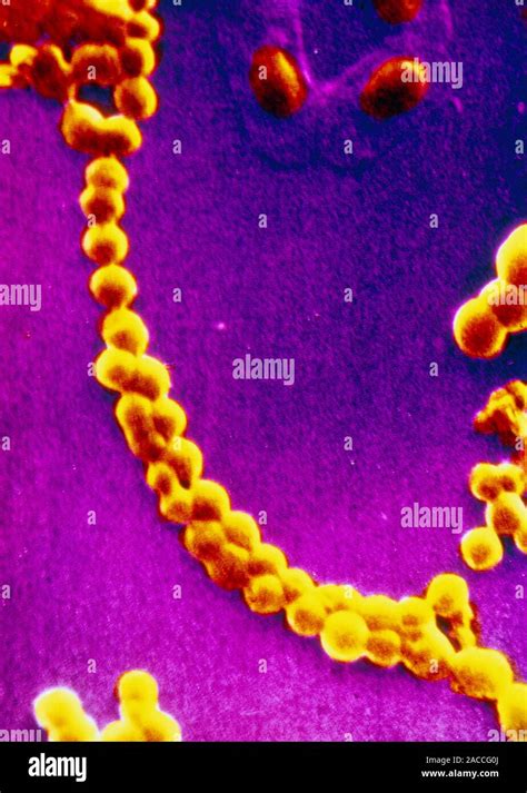 False Colour Scanning Electron Micrograph Sem Of Peptostreptococcus