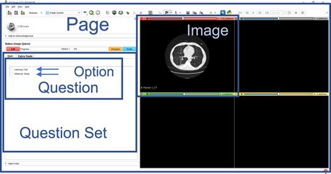 quiz building basics image quizzer documentation