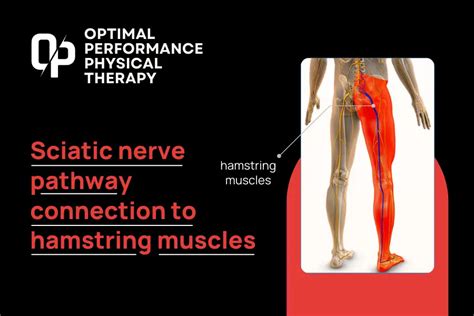 Hamstring Pain Treatment Complete Guide To Causes Symptoms Solutions