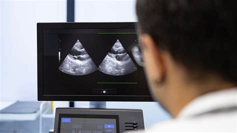 Ecu Developed Ai To Revolutionise Early Disease Detection Nutrition