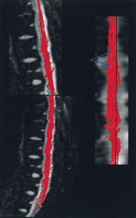 Three Dimensional Reconstructions Are Mapped Over The B0 Images Fiber
