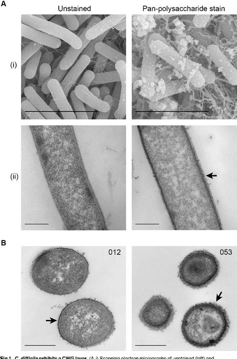 Table 1 From A Clostridium Difficile Cell Wall Glycopolymer Locus