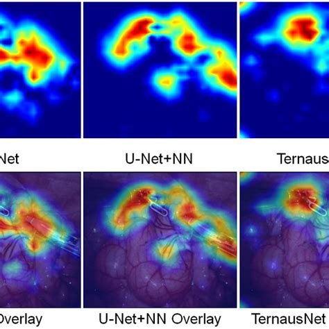 Attention Results U Netplus Looks At A Focused Target Region